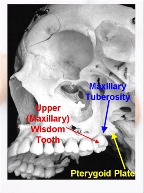 Maxillary Tuberosity Anatomy