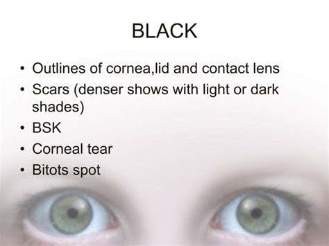 Eye Colour Coding