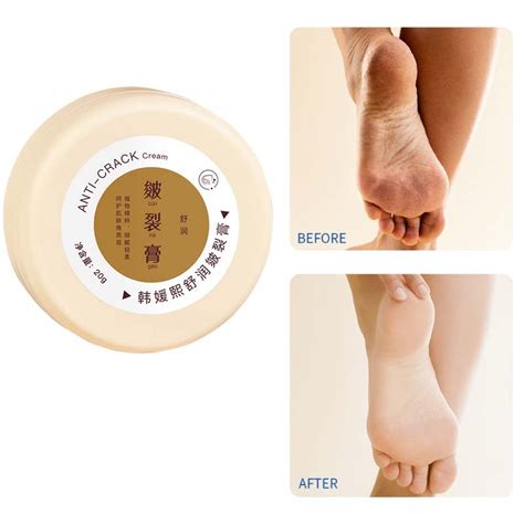 Heyxi Anti Cracking Cream Anti Drying Repairing Heel Frost Cracking