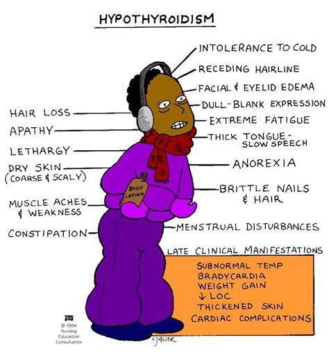 Hypothyroidism Nursing Nclex Endocrinesystem Hyperthyroidism Hypothyroidism Nursing