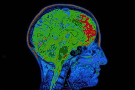 Do Bigger Brains Make Us Smarter A Moment Of Science Indiana