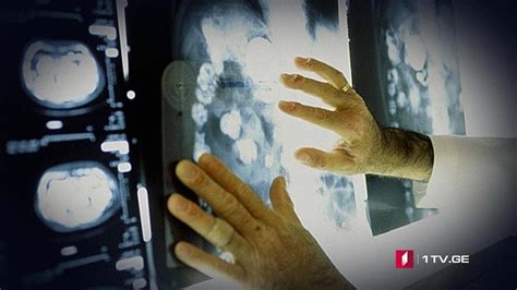 ონკოლოგიური პაციენტების მკურნალობის დაფინანსება Youtube