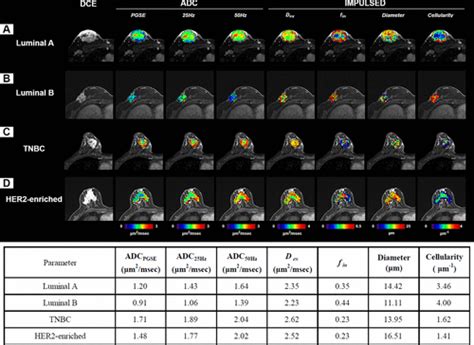 Time Dependent Diffusion Mri Helps Predict Molecular Subtypes And