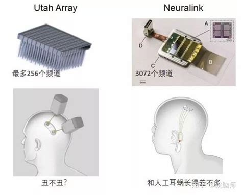 Neuralink