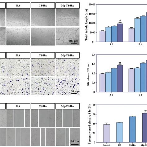 Evaluating Angiogenic Properties Of Huvecs Cultured In Ha Csha And