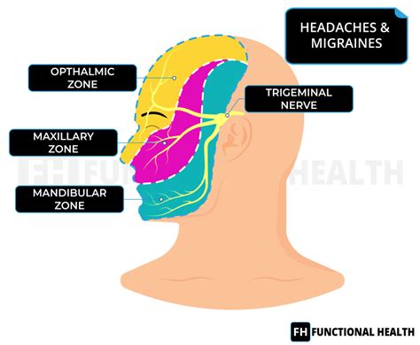 Headache Zones Trigeminal Nerve Functional Health Physiotherapy Physiotherapy Gold Coast