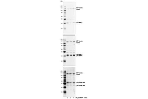 Signalsilence® Pool P38 Mapk Sirna Cell Signaling Technology