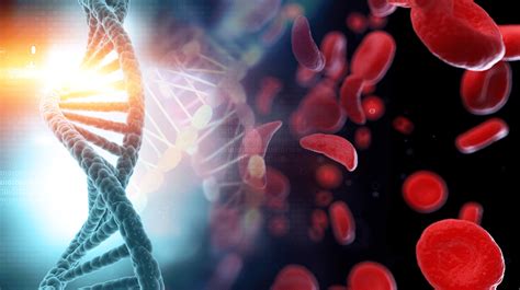 This Gene Editing Therapy Could Cure Sickle Cell Disease And Its