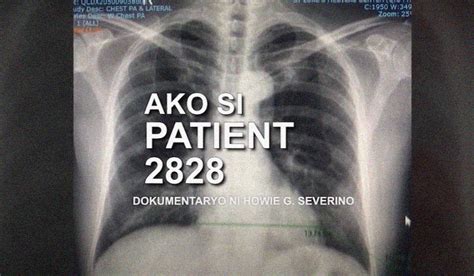 Journalist Howie Severino Shares Bold Eye Opening Look Into His