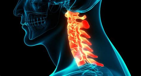 Fda Clears Vyspine Univy Osteovy Ti Cervical Ibf