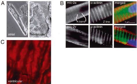 A Isolation Of Atrial And Ventricular Cardiomyocytes From Fresh Human