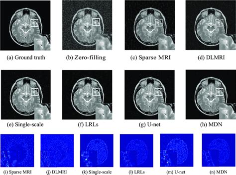 Reconstruction Results For 20 Variable Density Sampling A Original Download Scientific