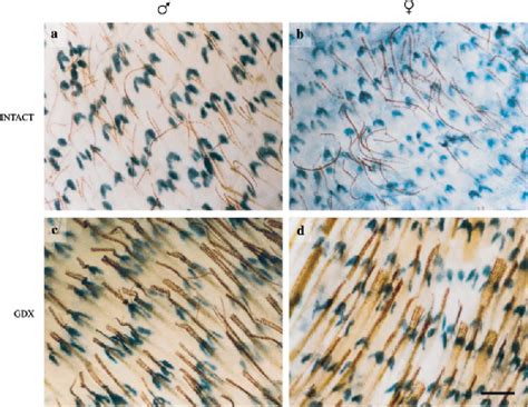 Figure 3 From Gender Differences In Mouse Skin Morphology And Specific Effects Of Sex Steroids