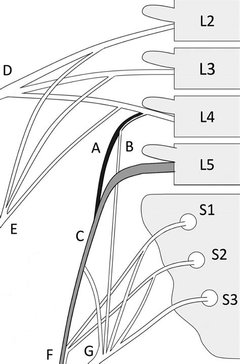 Schematic Demonstrating The Divisions Of The Lumbosacral Plexus The L4