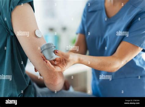 Nurse Applying A Continuous Glucose Monitor Sensor On Arm Of A Diabetic Teenager Cgm Device