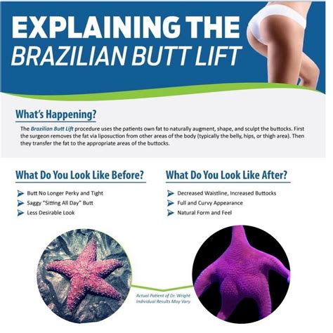 Thicc Starfish Becomes Internets Latest Viral Meme Ebaums World