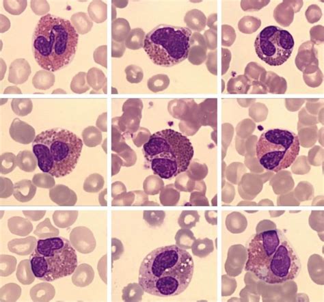 Eosinophiler Granulozyt Doccheck Flexikon