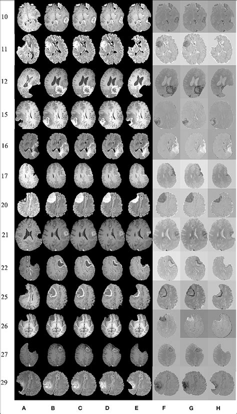 Frontiers Adaptive Physics Based Non Rigid Registration For Immersive