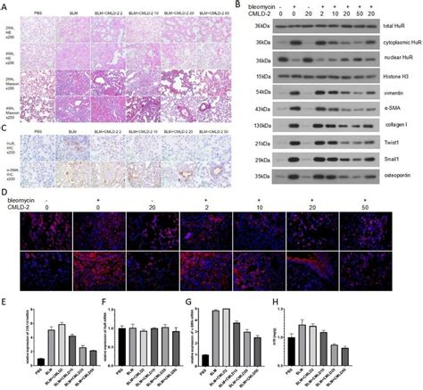 Cmld 2 Attenuates Bleomycin Induced Pulmonary Fibrosis In Mice This
