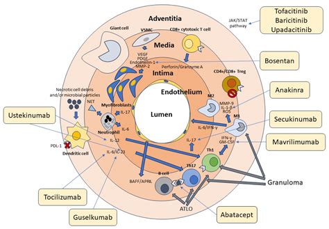 Giant Cell Arteritis Encyclopedia Mdpi