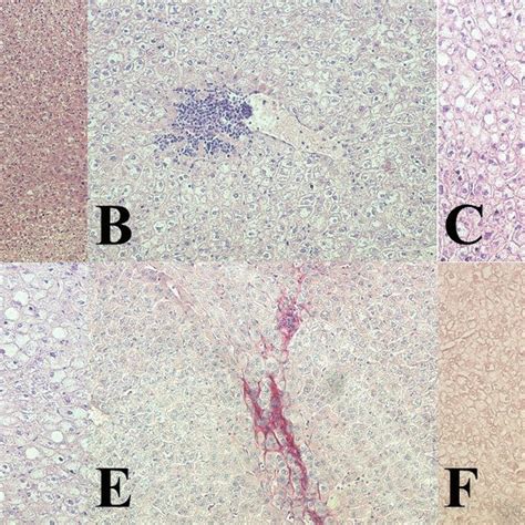 Microscopic View Rabbit Liver At Different Times Of Experiment A