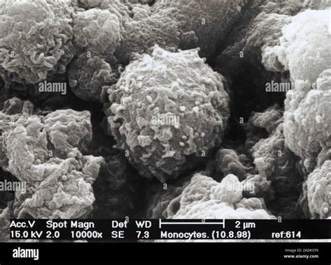 Monocyte Cells Scanning Electron Micrograph Sem Of Monocyte White
