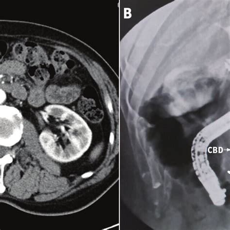 A A Contrast Enhanced Computed Tomography Scan Of The Abdomen Of A