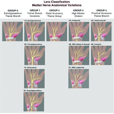 Schematic Of The Different Nerve Courses Lanz Types Download Scientific Diagram