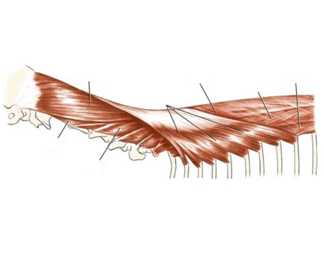 Epaxial Muscles Spine Extensors Quiz