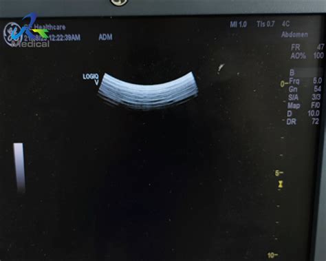 Ge 4c Rs Convex Probe Ultrasound Transducer Lens Replacement