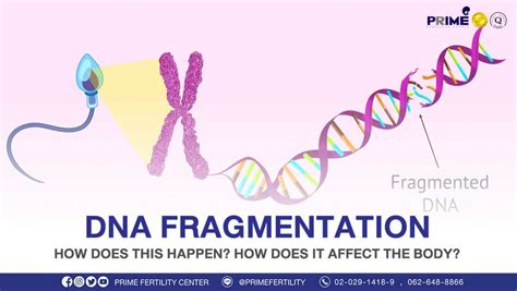 Dna Fragmentation How Does This Happen Prime Fertility Clinic Dna Fragmentation How Does This Happen Prime Fertility Clinic