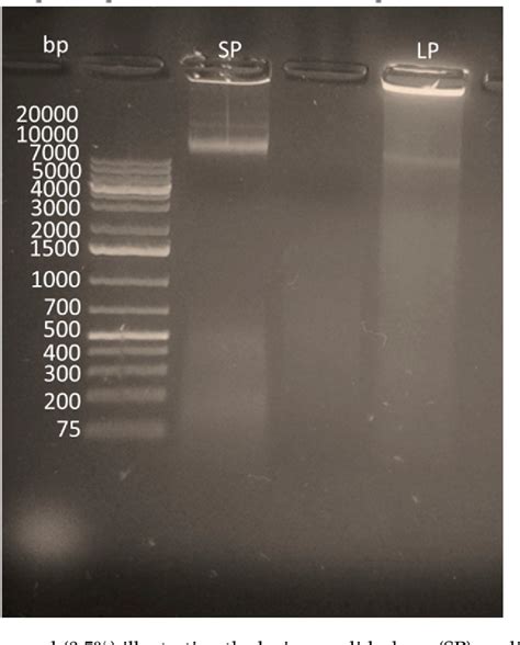 Figure 2 From Development Of Solid Phase Rpa On A Lateral Flow Device For The Detection Of