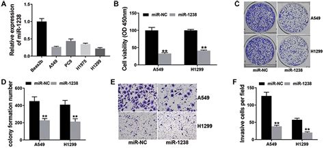 Circkif4a Promotes Non Small Cell Lung Cancer Proliferation And
