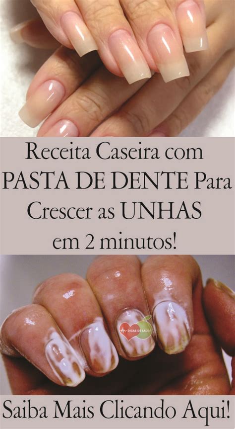 Coloque Um Pouco De Pasta De Dente Nas Unhas E Veja O Que Acontece