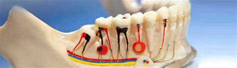 Endodontia Tratamento De Canal Especialidades Odontológicas
