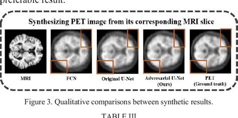 Figure From Cross Modality Synthesis From MRI To PET Using Adversarial U Net With Different