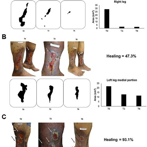 Macroscopic View Of The Healing Process And Quantification Of Lesion Download Scientific