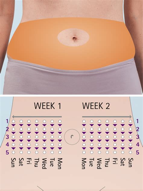 Printable Insulin Injection Site Rotation Chart