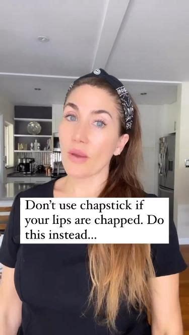 Next Time You Have Dry Lips Dont Apply Lip Balm ️ Do This Instead Dry Lips Lips Dark Skin