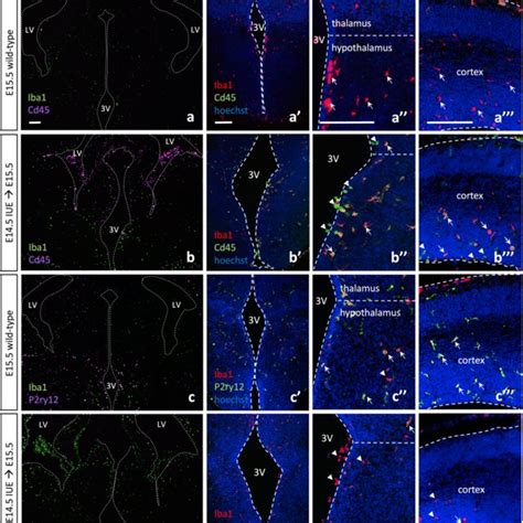 Altered Microglia Morphology Following In Utero Electroporation