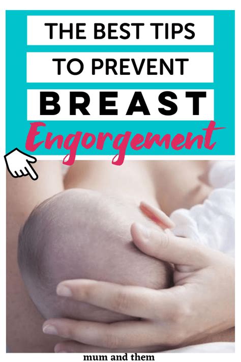 What Is Breast Engorgement Symptoms Amp Relief Ndash Mum And Them Artofit
