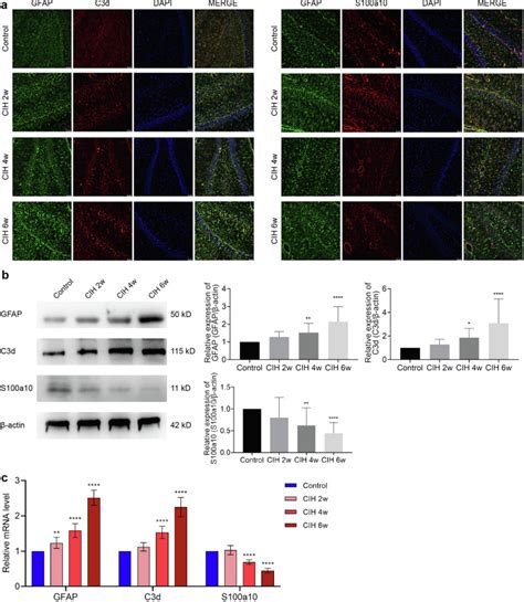 Nlrp3 Inflammasome Regulates Astrocyte Transformation In Brain Injury