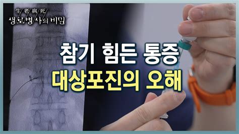 극심한 통증이 무서운 대상포진 과연 치료와 예방법은 없는 것일까 Kbs 20230222 방송 Youtube