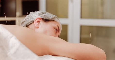 Does Acupuncture Help Fertility Acupuncture For Fertility