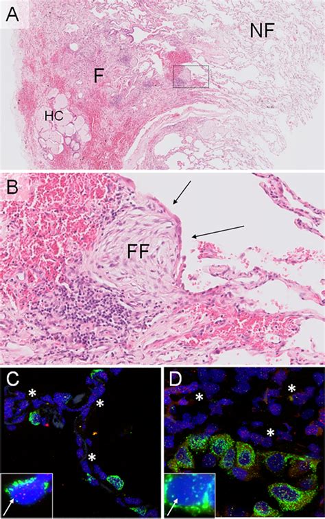 Images Showing Representative Regions For Non Fibrotic And Fibrotic