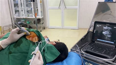 Subscapular Nerve Block Glenohumeral Joint Injection Drgmd Youtube