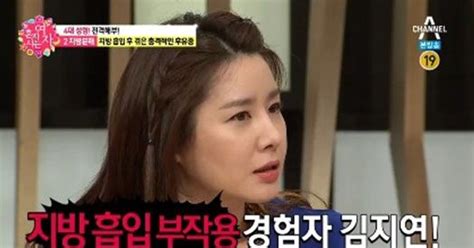 미코 진 출신 김지연 70kg 때 지방흡입살 찢는 듯한 부작용