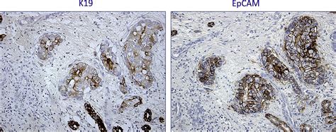 Hepatic Progenitor Cells An Update Clinics In Liver Disease