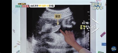 상상도 못한 태아 초음파 사진의 비밀 포텐 터짐 최신순 에펨코리아