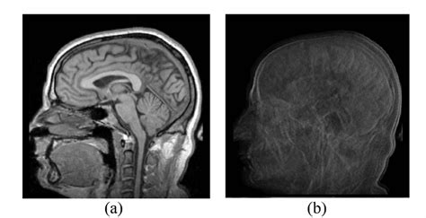 Figure 3 From Transfer Function Design For Volume Rendering Using K Means Clustering Semantic
